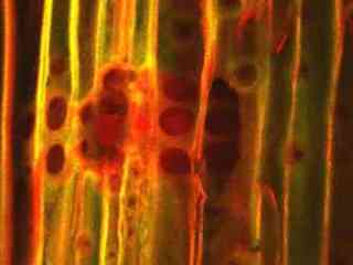 Confocal Microscopy | Nikon’s MicroscopyU