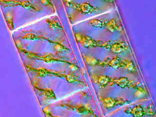 Digital Eclipse Image Gallery | Nikon’s MicroscopyU