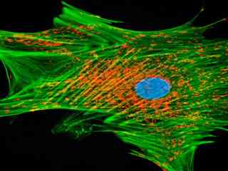 Animal and Human Cells in Culture | Nikon’s MicroscopyU