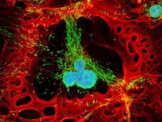 Animal and Human Cells in Culture | Nikon’s MicroscopyU