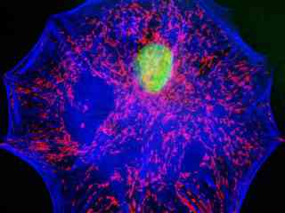 Animal and Human Cells in Culture | Nikon’s MicroscopyU