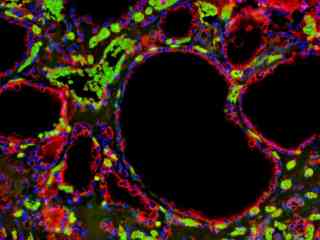 Fluorescence Microscopy | Nikon’s MicroscopyU