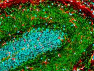 Fluorescence Microscopy | Nikon’s MicroscopyU