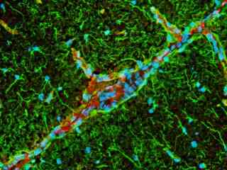 Rat Tissue Sections | Nikon’s MicroscopyU