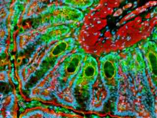 Rat Tissue Sections | Nikon’s MicroscopyU