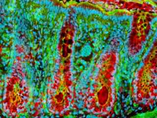 Rat Tissue Sections | Nikon’s MicroscopyU