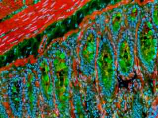 Rat Tissue Sections | Nikon’s MicroscopyU