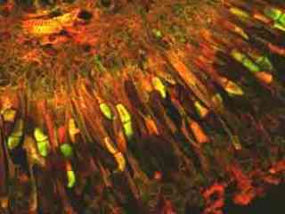 Confocal Microscopy | Nikon’s MicroscopyU