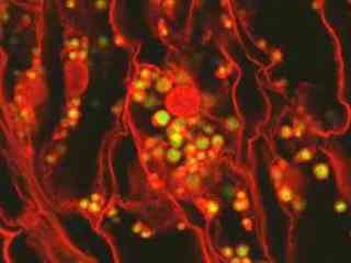 Confocal Microscopy | Nikon’s MicroscopyU