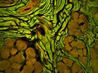 Confocal Microscopy | Nikon’s MicroscopyU