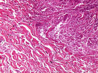 Human Pathology | Nikon’s MicroscopyU