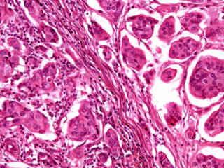 Human Pathology | Nikon’s MicroscopyU