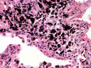 Human Pathology | Nikon’s MicroscopyU