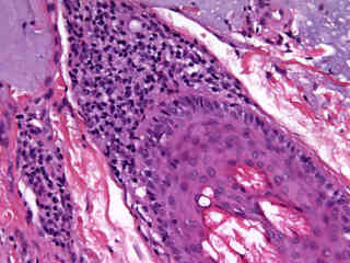 Human Pathology | Nikon’s MicroscopyU