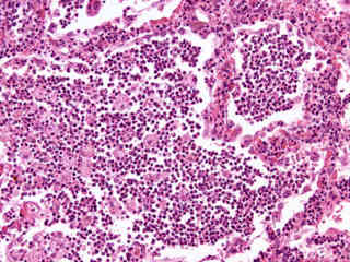 Human Pathology | Nikon’s MicroscopyU