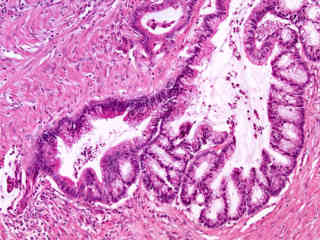 Human Pathology | Nikon’s MicroscopyU