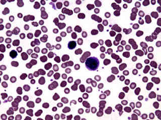 Human Pathology | Nikon’s MicroscopyU