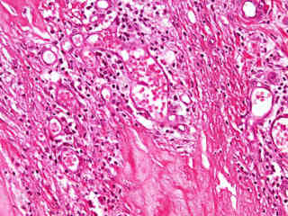 Human Pathology | Nikon’s MicroscopyU