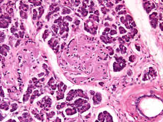 Human Pathology | Nikon’s MicroscopyU