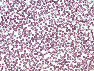 Human Pathology | Nikon’s MicroscopyU