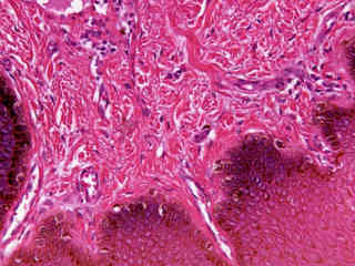 Human Pathology | Nikon’s MicroscopyU