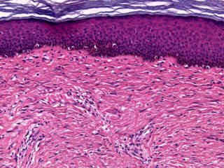 Human Pathology | Nikon’s MicroscopyU