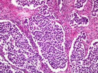 Human Pathology | Nikon’s MicroscopyU