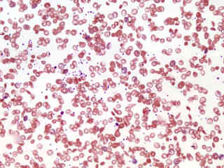 Human Pathology | Nikon’s MicroscopyU