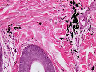 Human Pathology | Nikon’s MicroscopyU