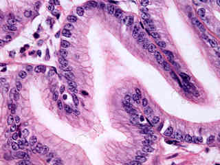 Human Pathology | Nikon’s MicroscopyU