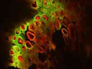 Confocal Microscopy | Nikon’s MicroscopyU