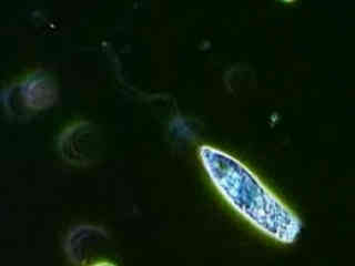 Pond Life Video Gallery | Nikon’s MicroscopyU