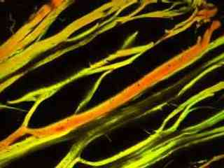 Confocal Microscopy | Nikon’s MicroscopyU