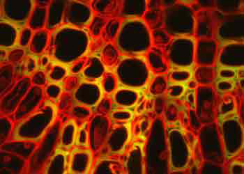 Apple Cedar Rust | Nikon’s MicroscopyU