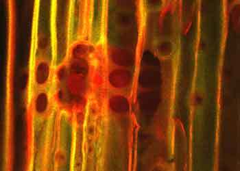 Bordered Pits | Nikon’s MicroscopyU