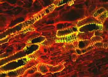 Cabbage Club Root | Nikon’s MicroscopyU