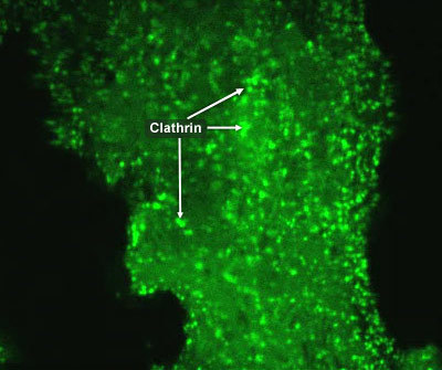 Imaging of Clathrin Vesicles in Fibroblast Cells | Nikon’s MicroscopyU