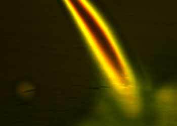 Frog Eye (40x Magnification) | Nikon’s MicroscopyU