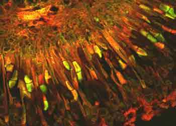 Hollyhock Rust Fungus | Nikon’s MicroscopyU