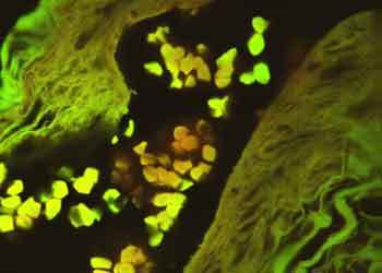 Human Gallbladder | Nikon’s MicroscopyU