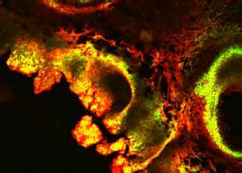 Lichen Thallus | Nikon’s MicroscopyU