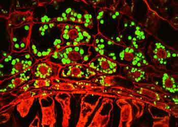 Lily Anther Prophase | Nikon’s MicroscopyU