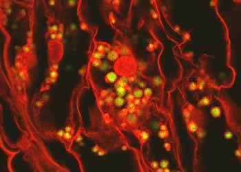 Lily Embryo, Specimen 2 | Nikon’s MicroscopyU