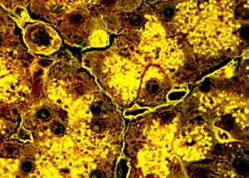 Mammalian Vater-Pacini (Pacinian) Corpuscles | Nikon’s MicroscopyU