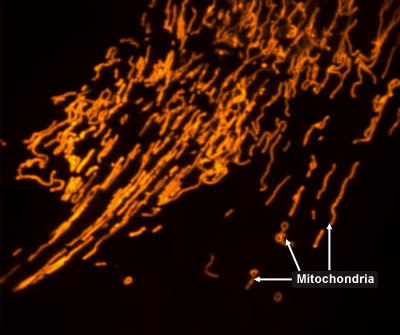 Imaging of Mitochondria with Orange Fluorescent Proteins | Nikon’s ...