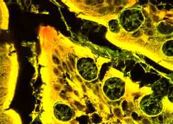 Peyer’s Patches | Nikon’s MicroscopyU