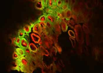 Pine Blister Rust | Nikon’s MicroscopyU