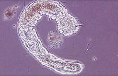 Aeolosoma (Annelida) Videos | Nikon’s MicroscopyU