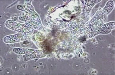 Amoeba (Protozoan) Videos | Nikon’s MicroscopyU