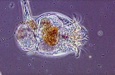 Brachionus (Rotifera) Videos | Nikon’s MicroscopyU